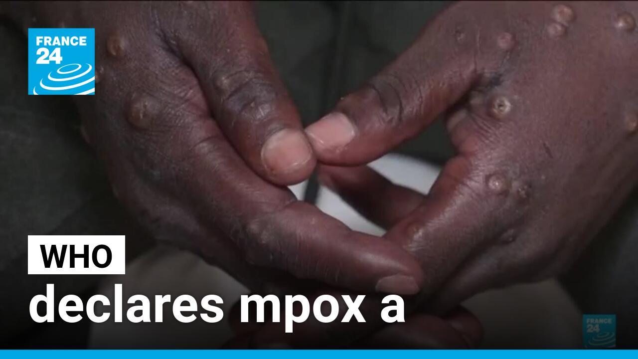 World Health Organization declares mpox a global health emergency - France 24